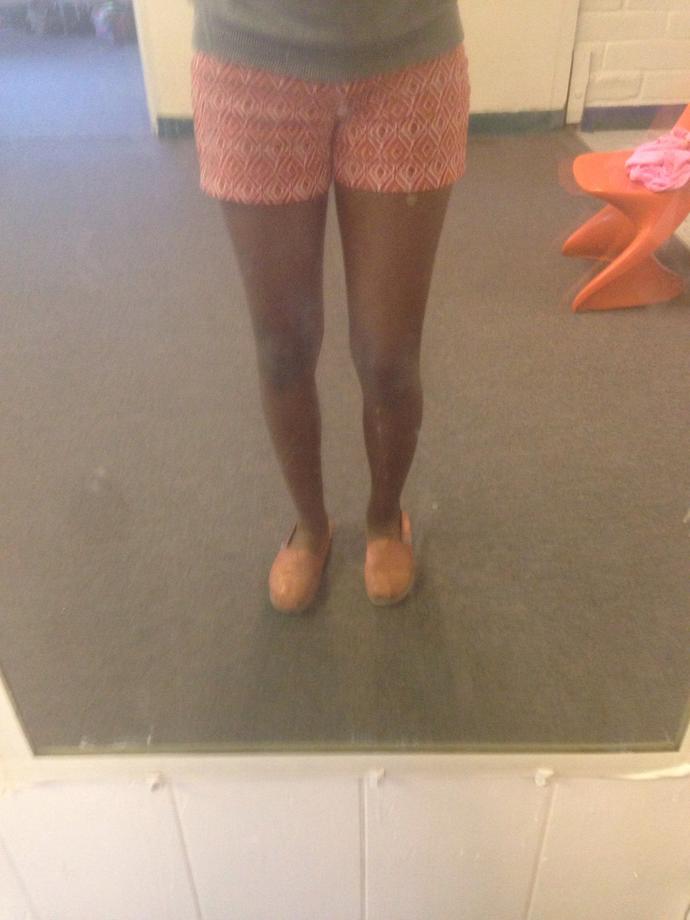 Why Are People Staring At My Legs GirlsAskGuys