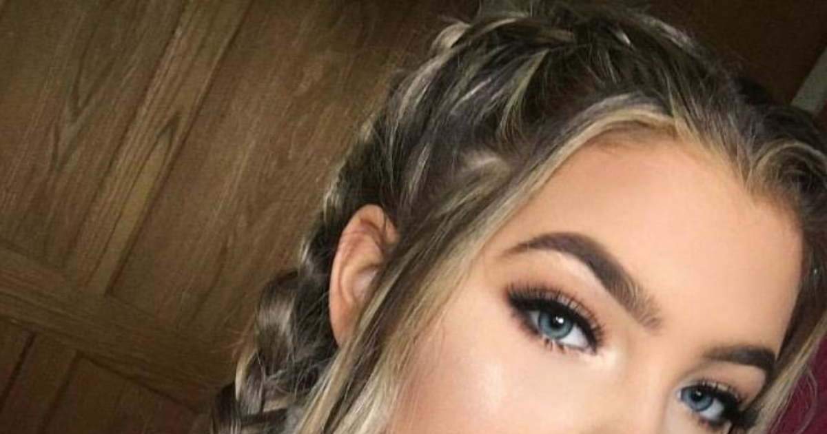 Hot Instagram Blondes Who Had Lip Augmentation