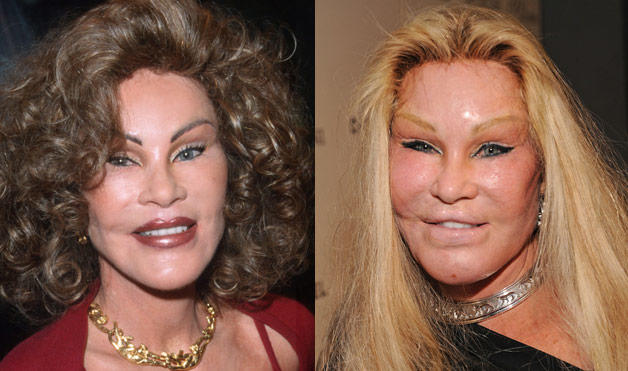 Shocking Plastic Surgery Fails That You Won't Believe - GirlsAskGuys