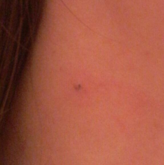 I have these weird black dots on my body, any clue on what they are ...