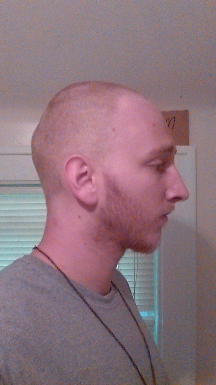 Freaky Weird Bald Headed People Freaky Weird Bald Headed People