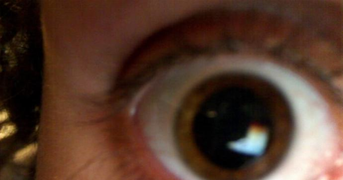 Who else thinks coked out meth pupils look great on girls? - GirlsAskGuys