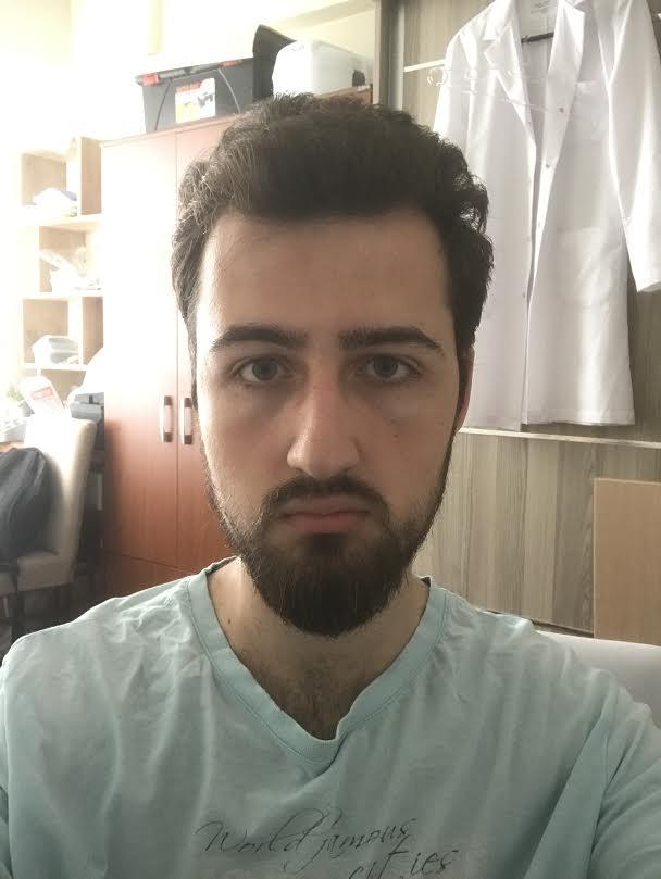 I lost some weight but is my face too slim? - GirlsAskGuys