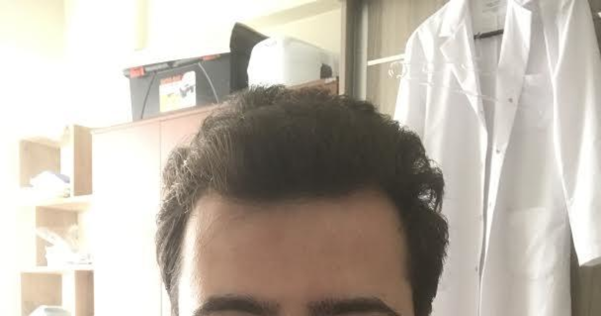 I lost some weight but is my face too slim? - GirlsAskGuys