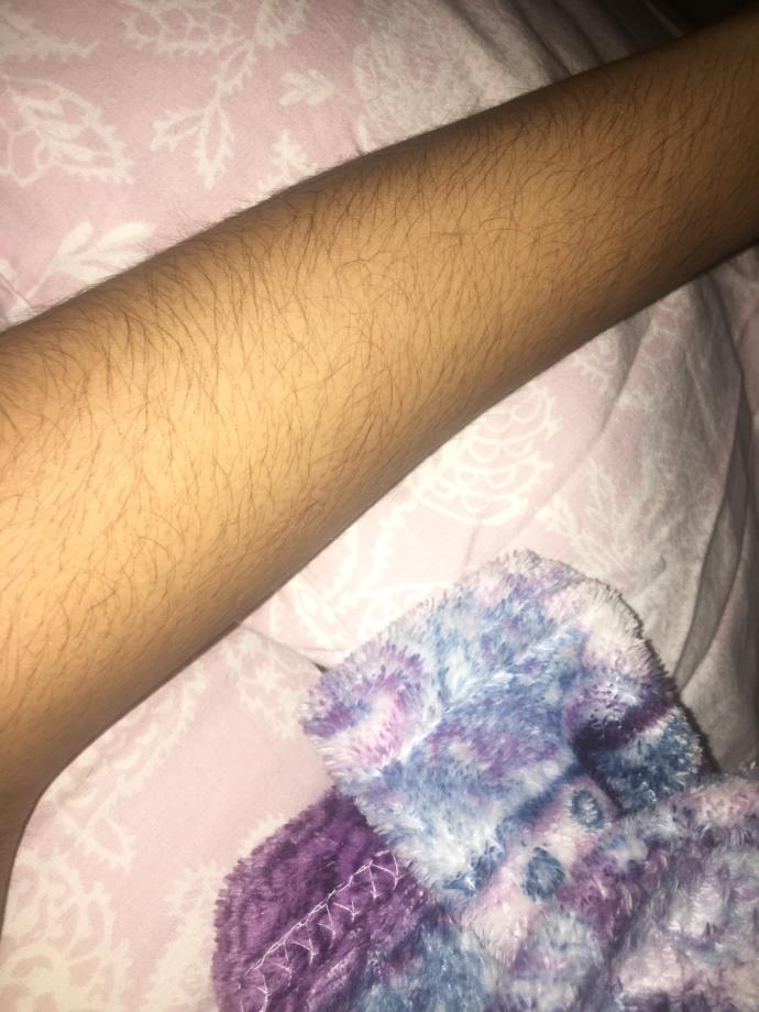 Are hairy arms on a girl a dealbreaker for you? - GirlsAskGuys