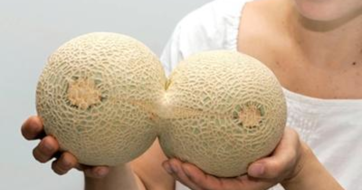 Rate My Melons Girlsaskguys