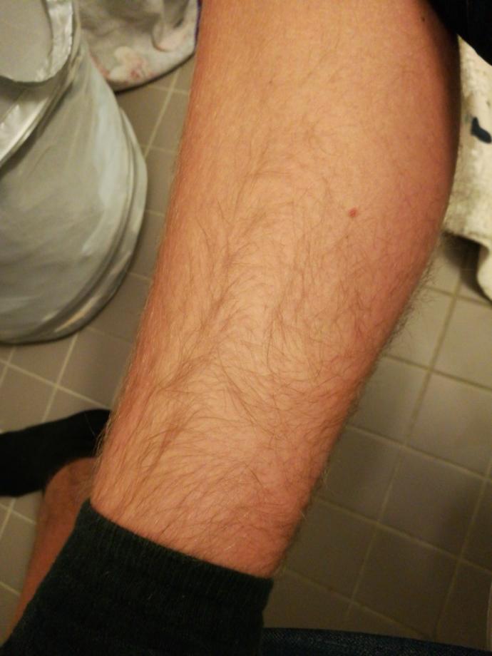 Is this too much leg hair? should I trim it? - GirlsAskGuys