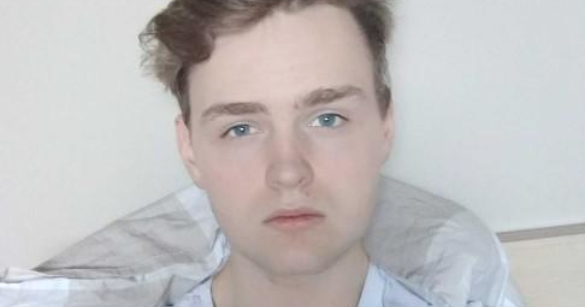 How can I fix my resting sad face? ? - GirlsAskGuys