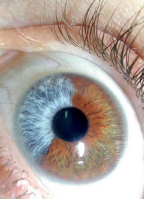 Do You Like Heterochromatic Iridium? - GirlsAskGuys