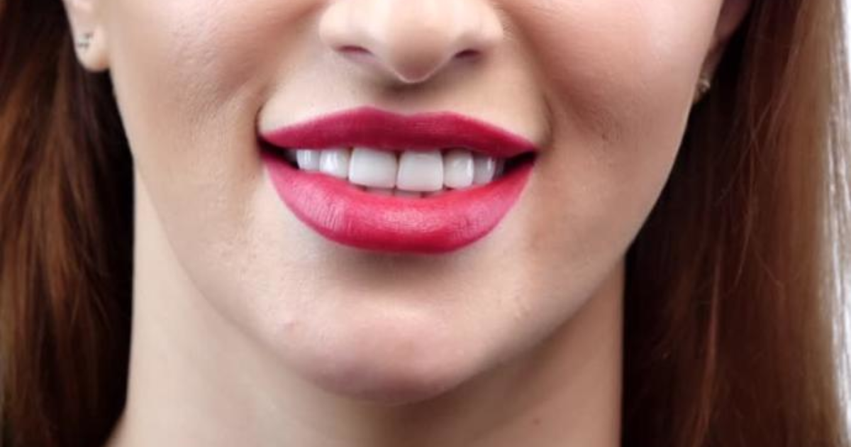 Are big/wide teeth unattractive? - GirlsAskGuys