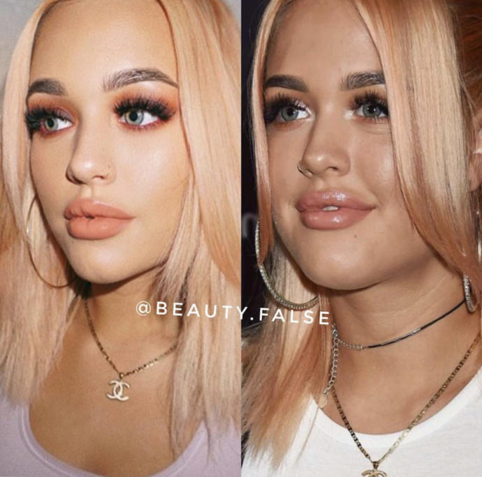 Bad angles or photoshop? - GirlsAskGuys