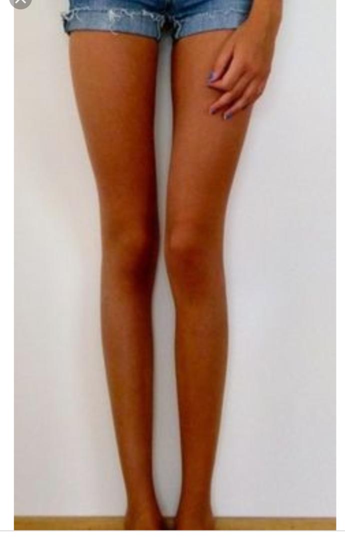 Are Skinny Legs Attractive Or Unattractive GirlsAskGuys