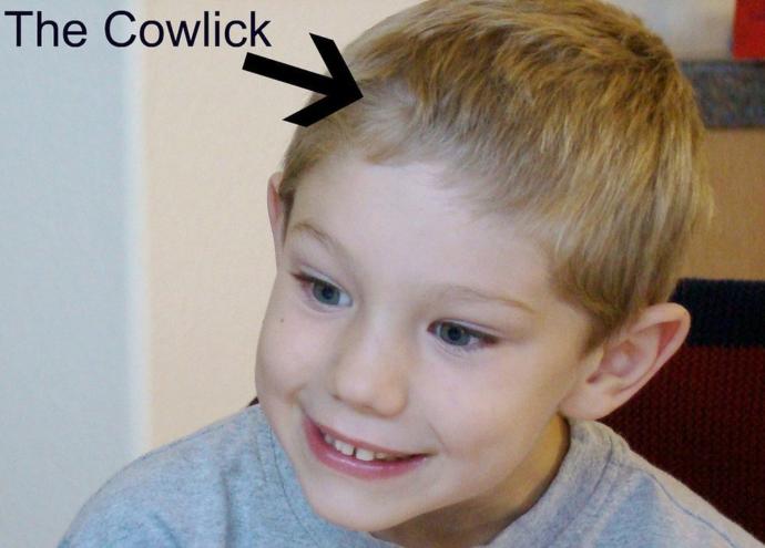 Bald spot at 16... what to do? - GirlsAskGuys