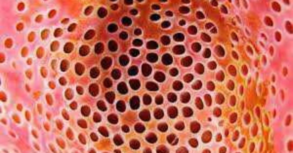 Do you have trypophobia? - GirlsAskGuys