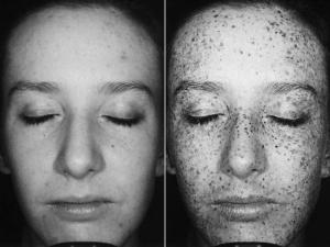 Why do people generally look better tan? - GirlsAskGuys