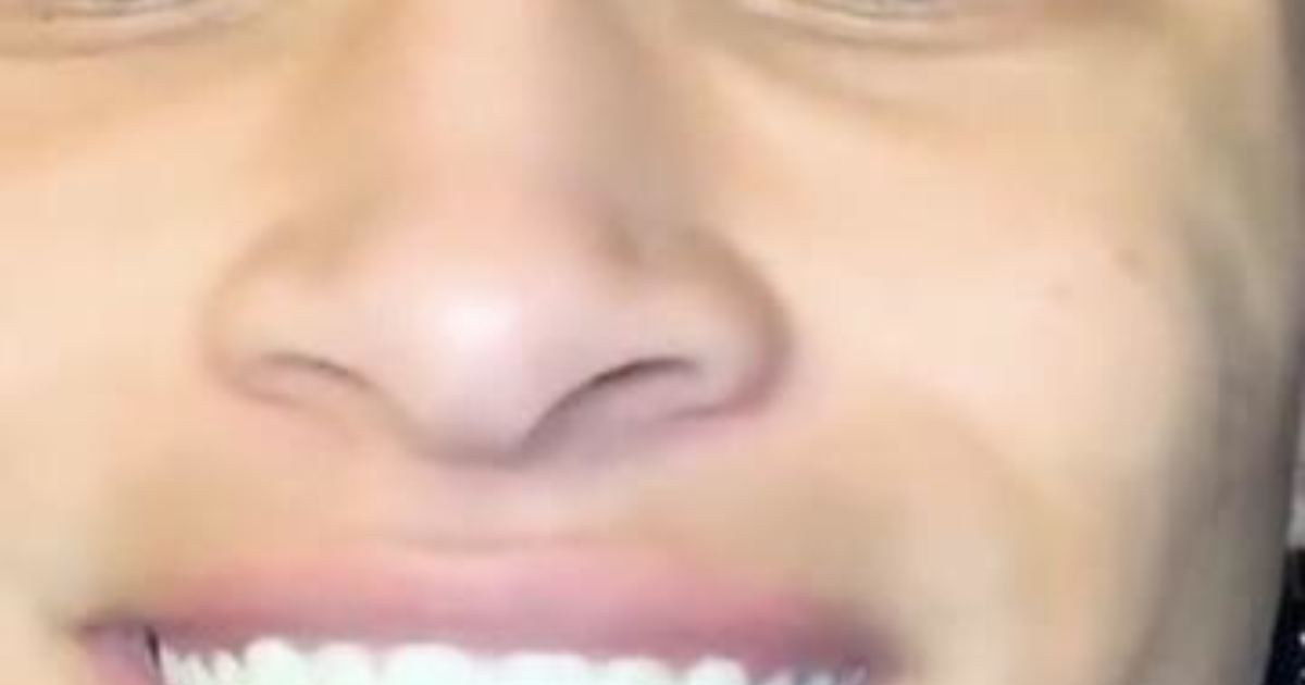 Anyone else think “fangs” are attractive? Or am I a weirdo? - GirlsAskGuys