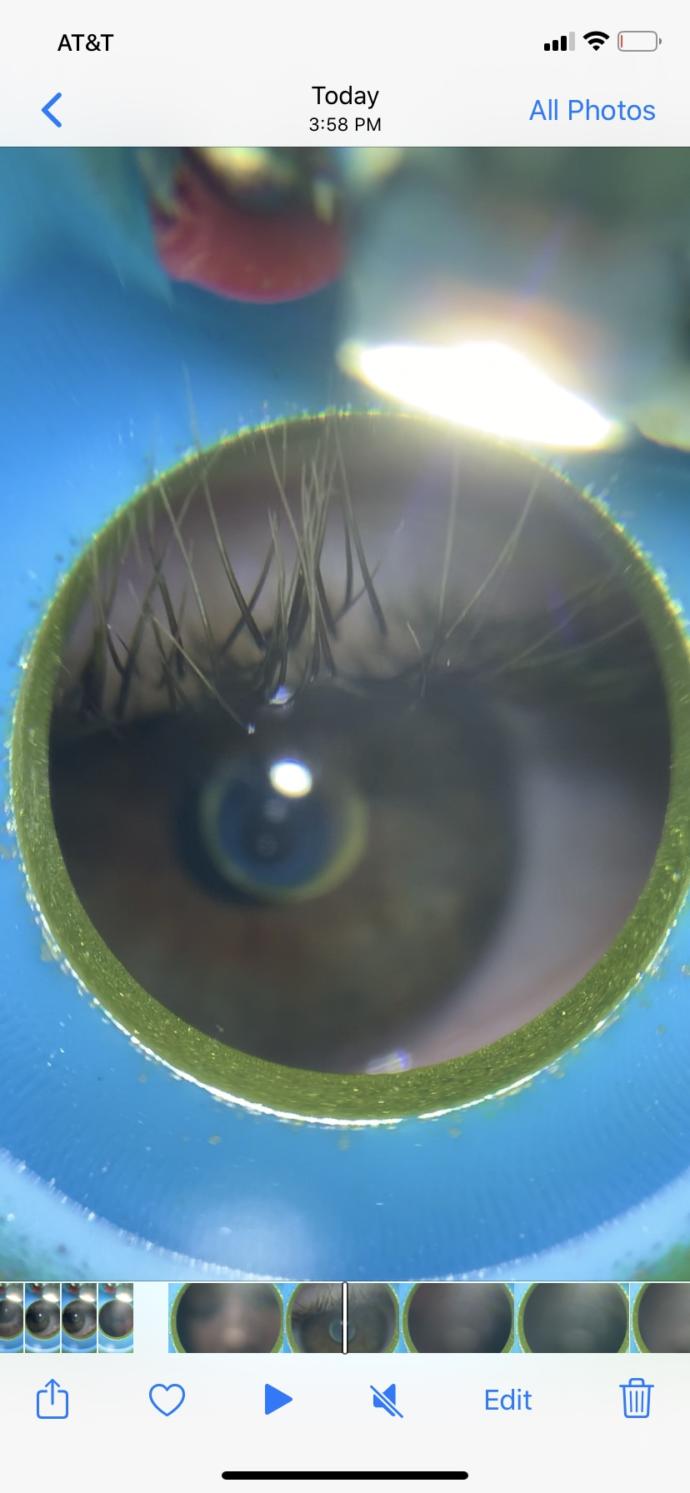 Do I have distichiasis? - GirlsAskGuys