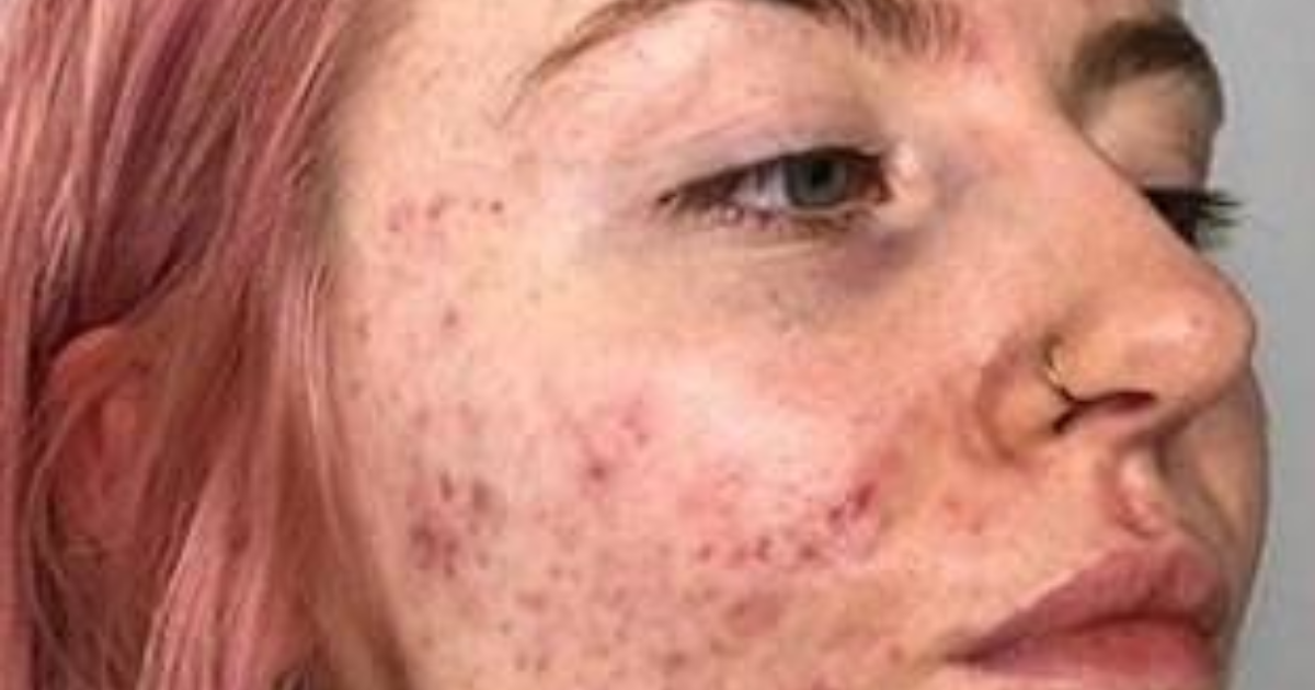 When You See This Picture of Abbie Bull, What Comes To Mind? - GirlsAskGuys