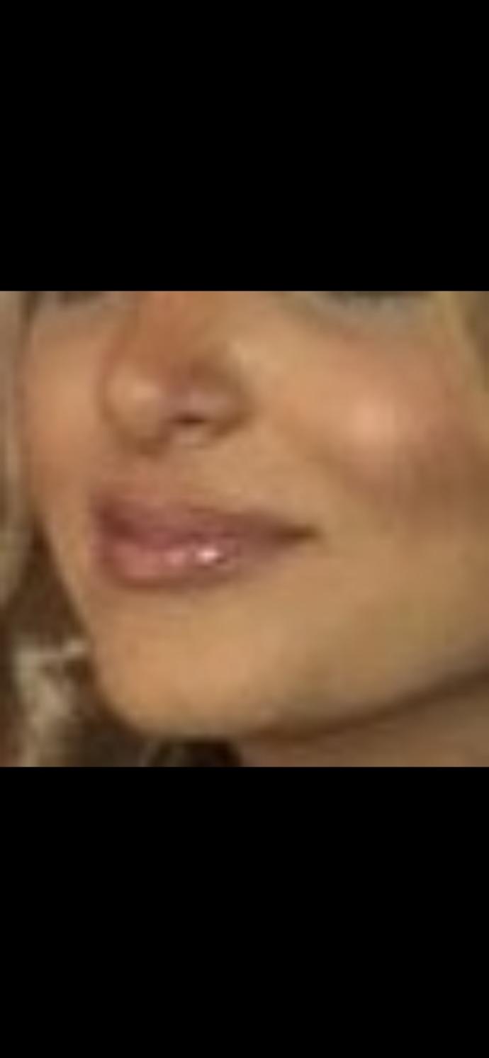 Does she have a nose job? - GirlsAskGuys