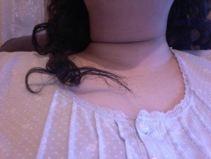 Why do I have a strange deep crease in the middle of my neck ...