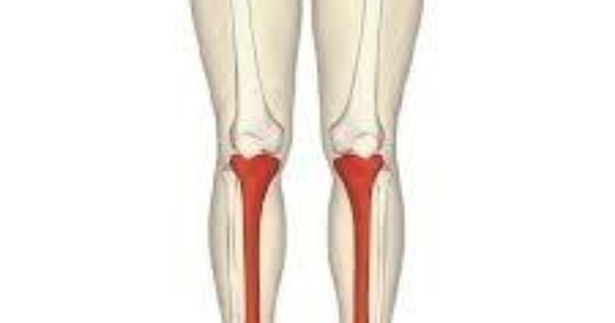 If you feel along your shin bone do you feel bumps from running into ...