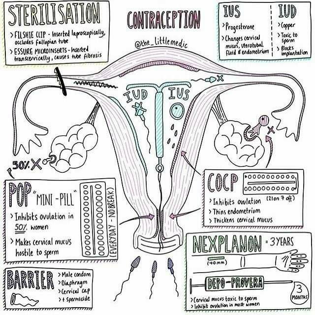 Does pulling out always work? - GirlsAskGuys