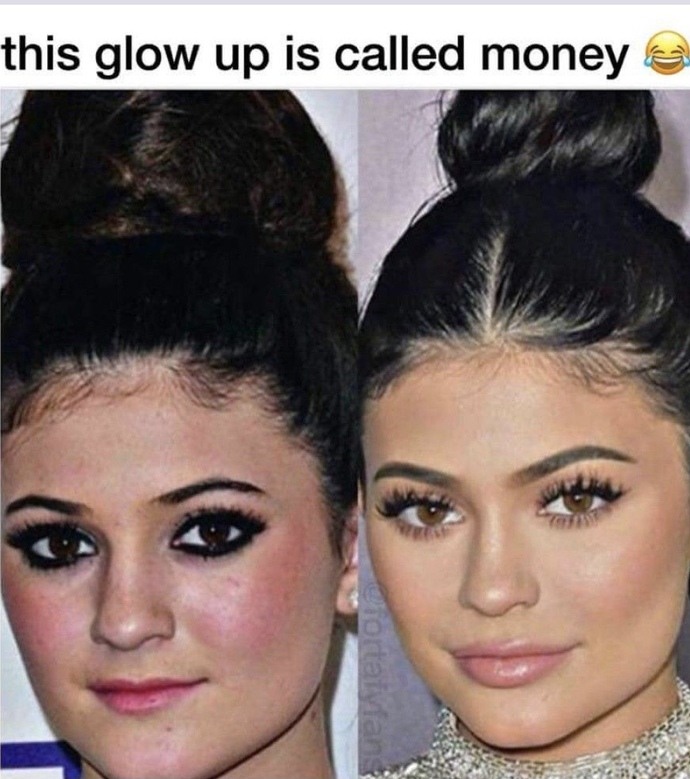 What age did you have your “glow up” and how long did it last ...