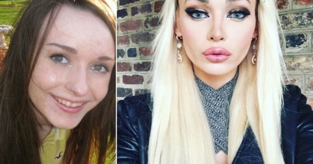 Is she prettier before or after plastic surgery? - GirlsAskGuys