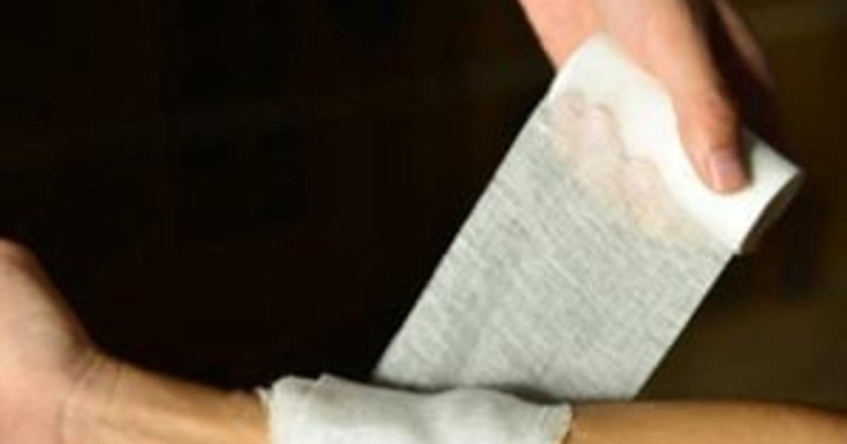 Why is a girl constantly patching me up? - GirlsAskGuys