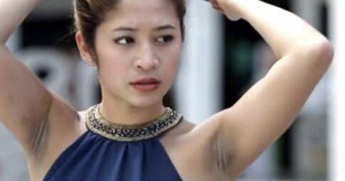 Ladies: what causes dark underarm and how to treat it? - GirlsAskGuys