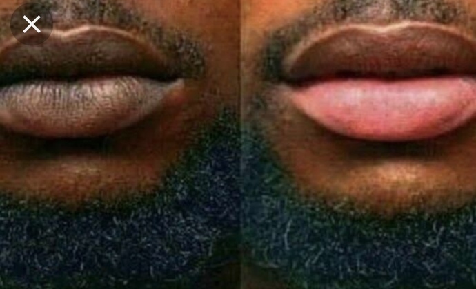 This one got the smokers does your lips and gums return back to normal ...