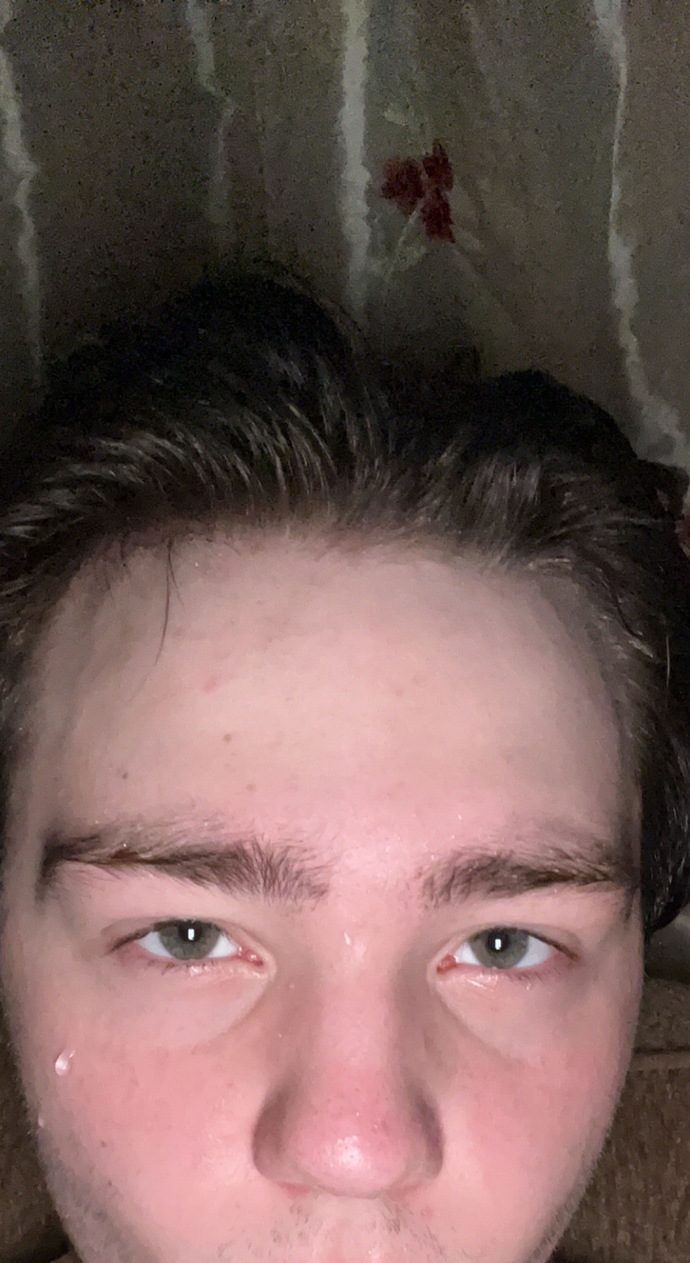 Bald spot or not? - GirlsAskGuys
