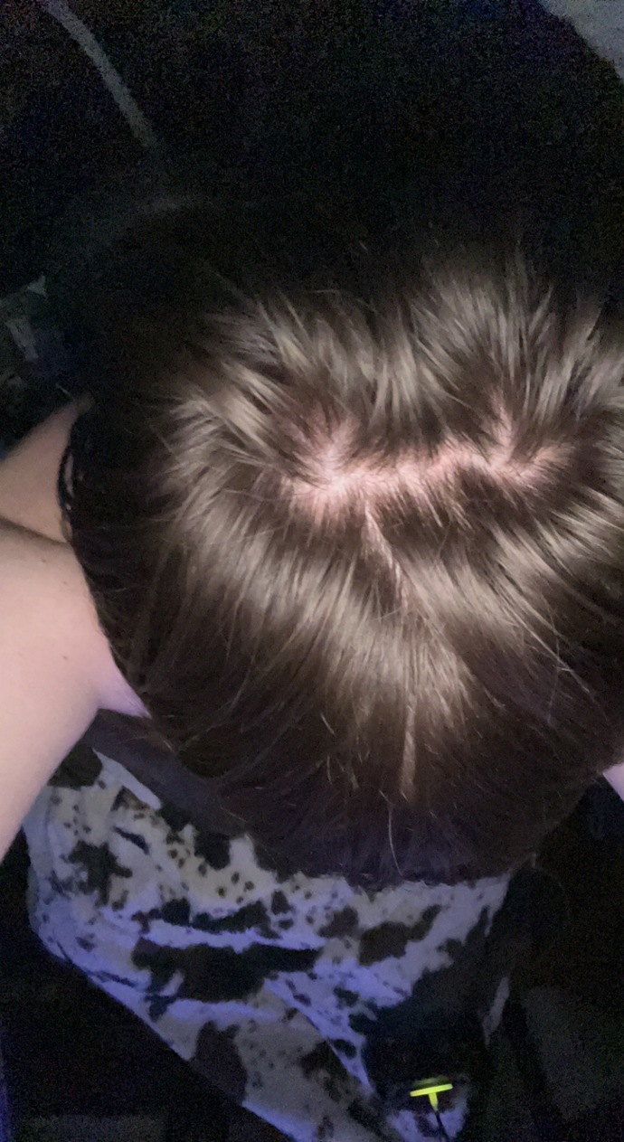 Bald spot or not? - GirlsAskGuys