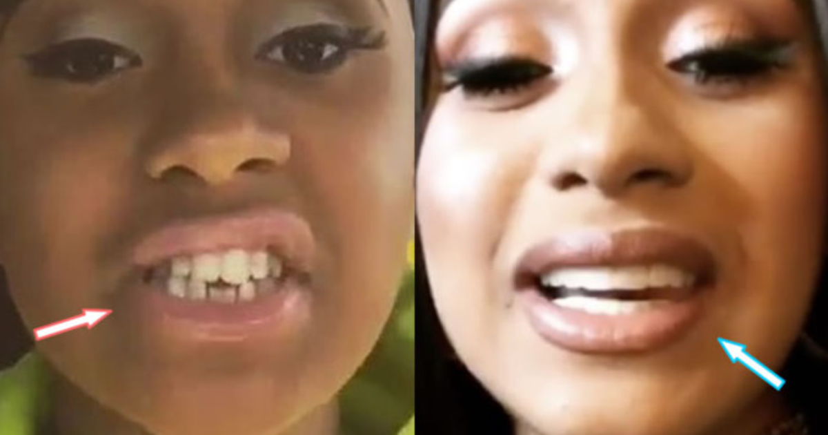 Were Cardi B‘s teeth really thst bad? - GirlsAskGuys