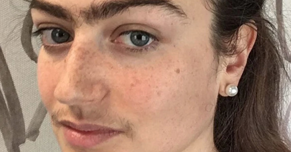 How do you feel about women with facial hair? - GirlsAskGuys