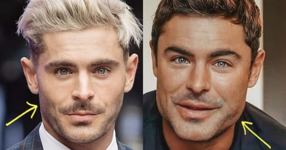 What tf happened to Zac Efron’s face? - GirlsAskGuys
