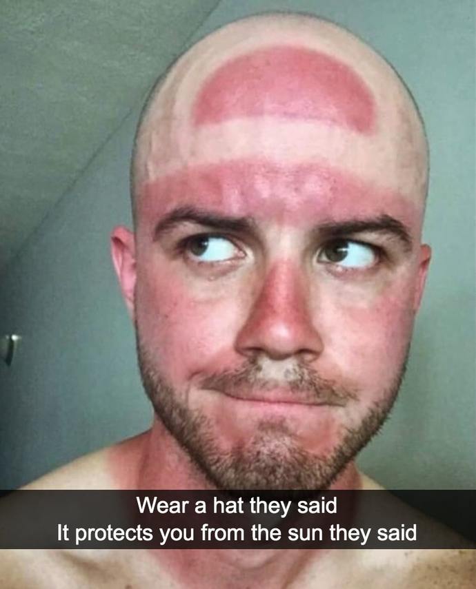 What was your funniest tanning fail? - GirlsAskGuys