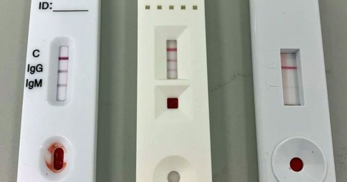 Have YOU tested positive for covid yet at all? - GirlsAskGuys