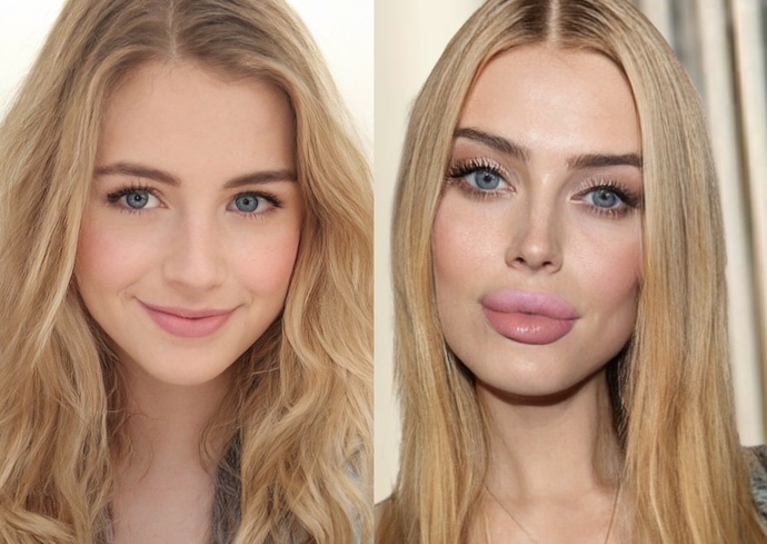 Does this Russian model look good with cosmetic procedures? - GirlsAskGuys