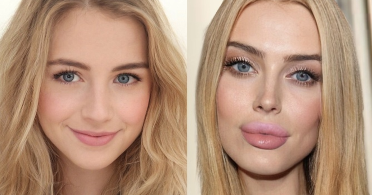 Does this Russian model look good with cosmetic procedures? - GirlsAskGuys