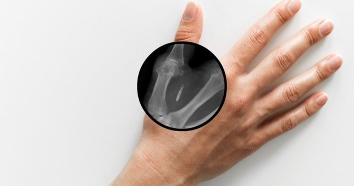 Government demands you must get micro chipped or else you can't buy ...