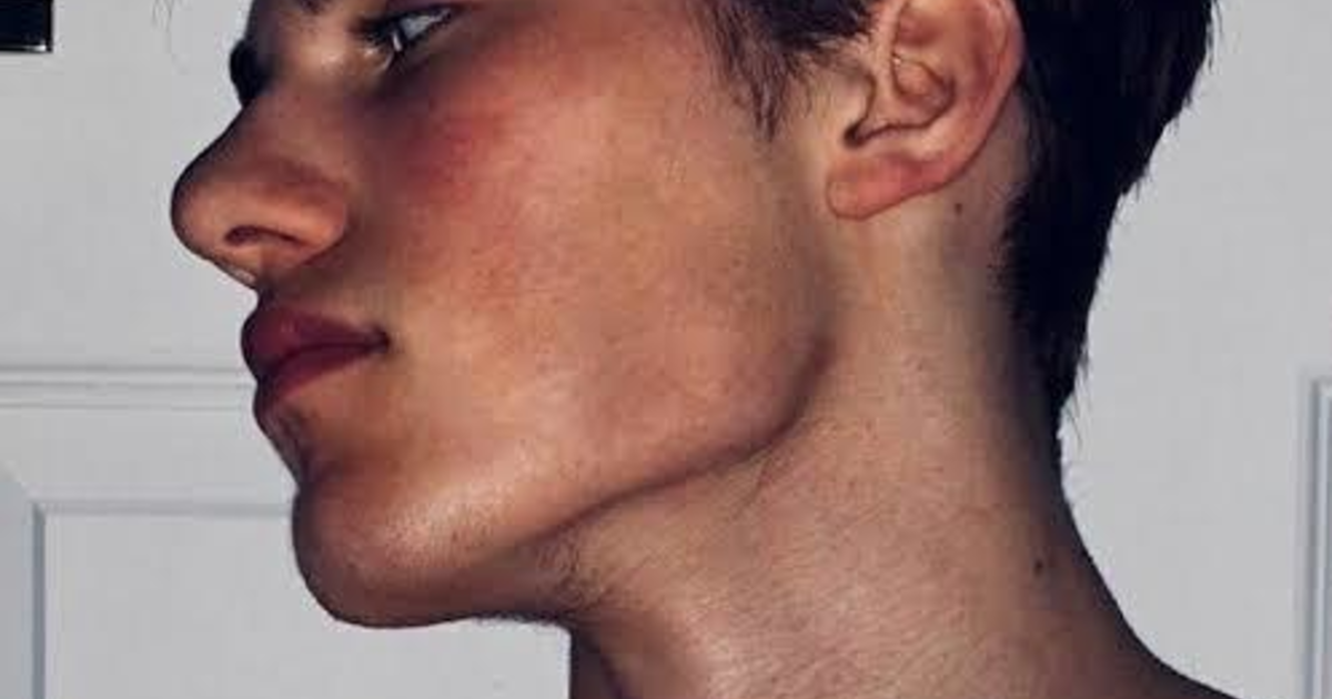 Do you like sharp a jawline? If yes then why? - GirlsAskGuys