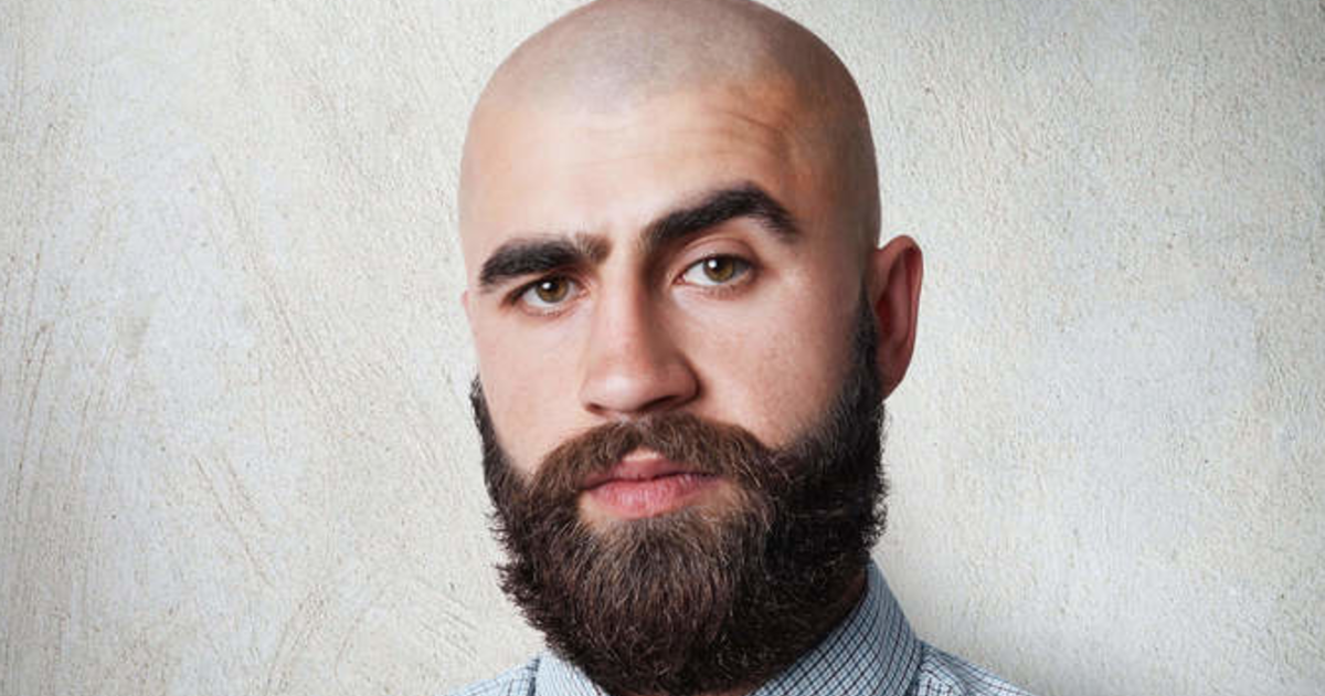 Balding guy at 20, what may I do to compensate for this flaw ...