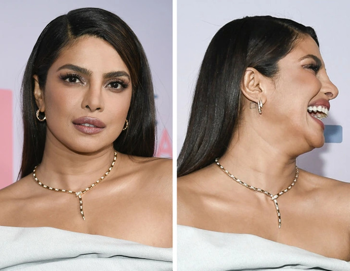 Do you have a better looking front profile or side profile? - GirlsAskGuys