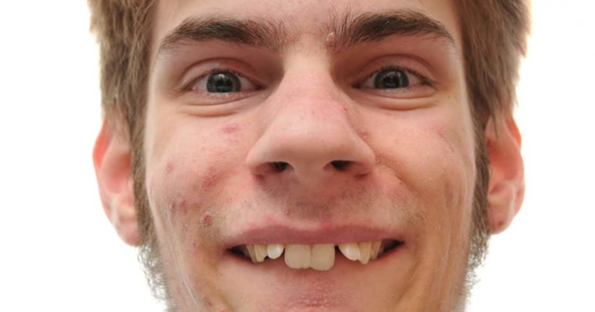 Why don't people who have messed up teeth and can afford it just go fix ...