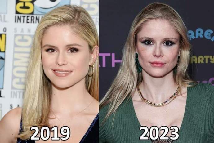 Why do women ruin their looks with plastic surgery very often ...