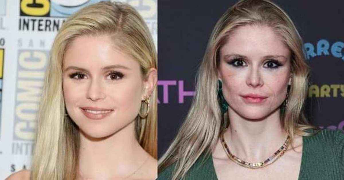 Why do women ruin their looks with plastic surgery very often ...