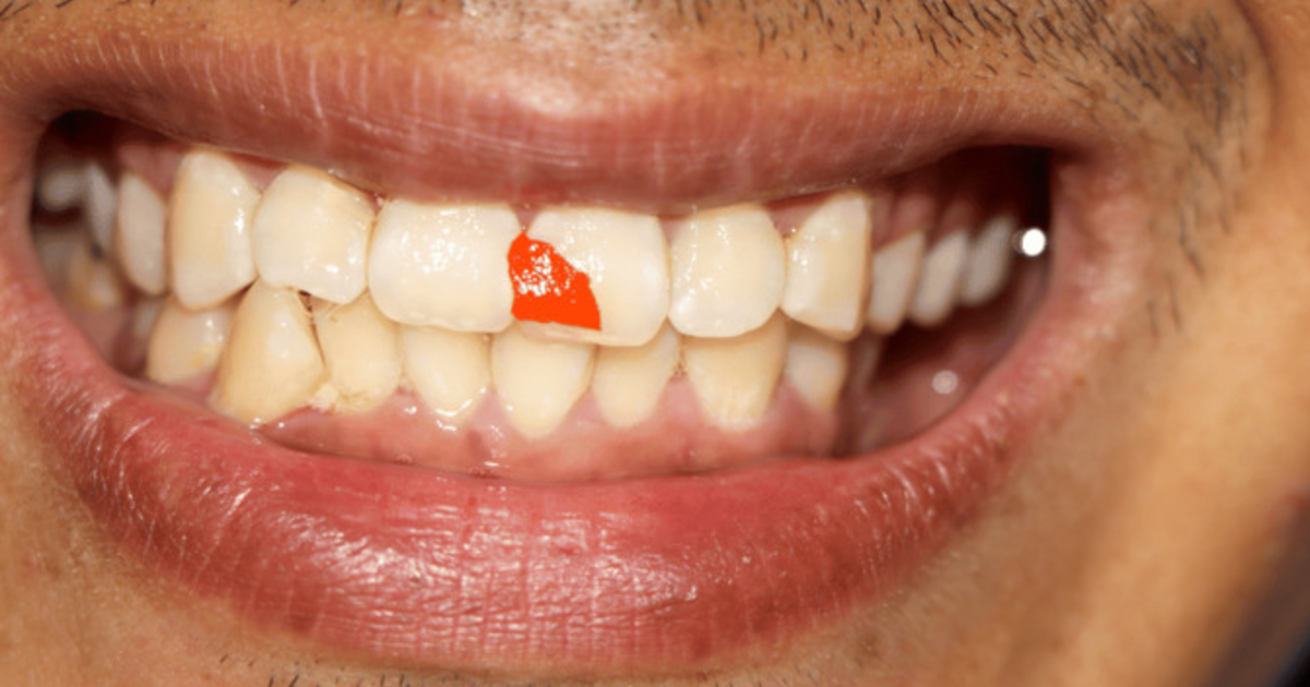 How do you remove FOOD PARTICLES from between your TEETH? - GirlsAskGuys