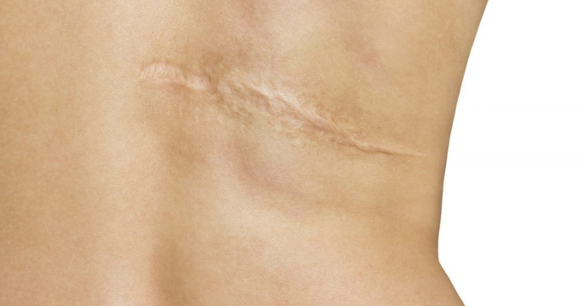 Do you have an impressive scar? - GirlsAskGuys