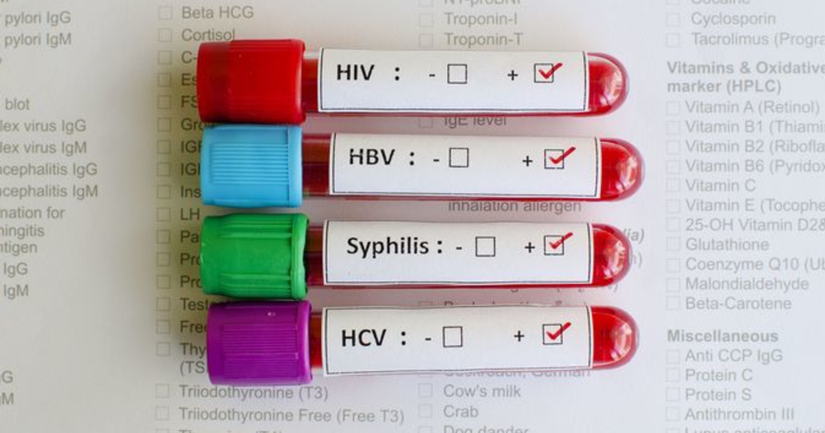 How often and why do you get STI/STD tested by your general ...